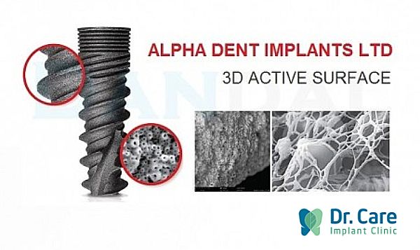 Trụ Implant Alphadent - Tìm hiểu xuất xứ, ưu điểm và giá cả | Dr. Care